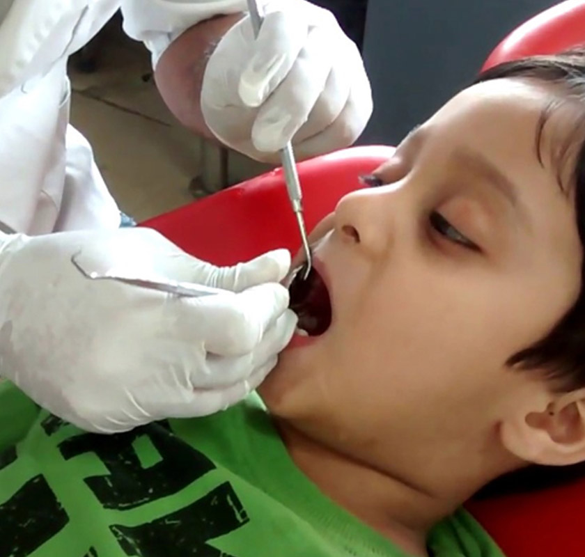Low Cost Kids Root Canal Treatment South Delhi India